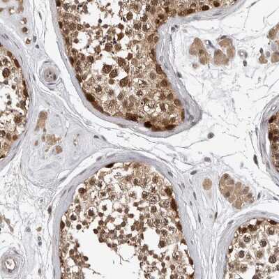 HENMT1 Antibody (NBP1-88330): Novus Biologicals