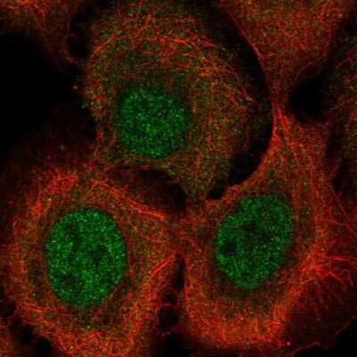 HES5 Antibody (NBP2-56999): Novus Biologicals