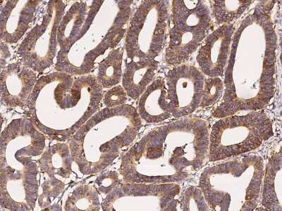 HEXB Antibody (NBP3-00084): Novus Biologicals