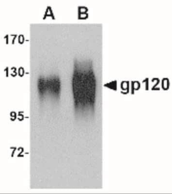 HIV-1 gp120 Antibody - BSA Free (NBP2-41090): Novus Biologicals