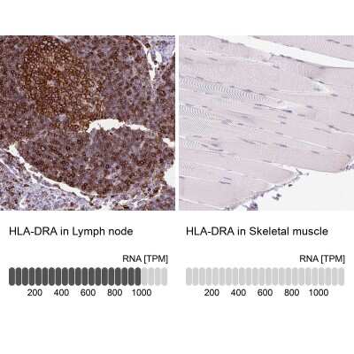 HLA DRA Antibody (NBP2-38619): Novus Biologicals