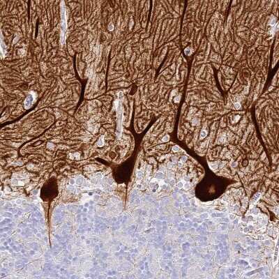 HOMER3 Antibody (NBP2-32607): Novus Biologicals