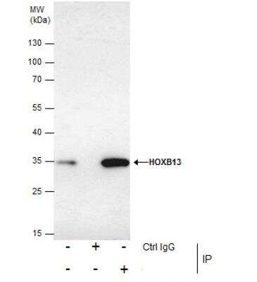 HOXB13 Antibody (NBP2-43655): Novus Biologicals
