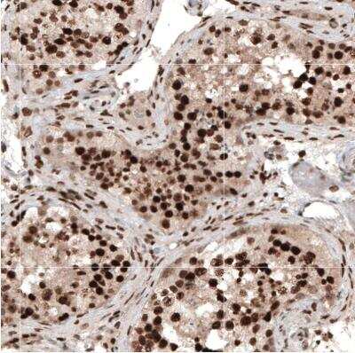 HP1 alpha Antibody (NBP1-89672): Novus Biologicals