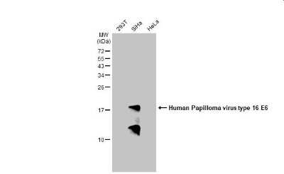 HPV16 E6 Antibody (NBP3-13128): Novus Biologicals