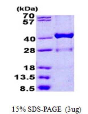 Recombinant Human 17 beta-HSD1/HSD17B1 His Protein (NBP2-23127): Novus ...