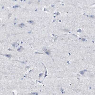 Hemogen Antibody (NBP1-84908): Novus Biologicals