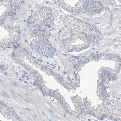 IFI27 Antibody (NBP1-84745): Novus Biologicals