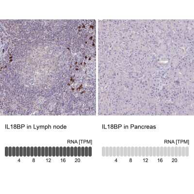 IL-18 BPa/IL18BP Antibody (NBP2-38481): Novus Biologicals