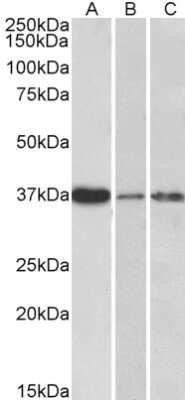 IL12B Antibody (NB100-61661): Novus Biologicals