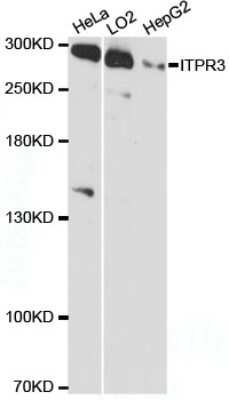 IP3R3 Antibody - Azide and BSA Free (NBP3-03498): Novus Biologicals