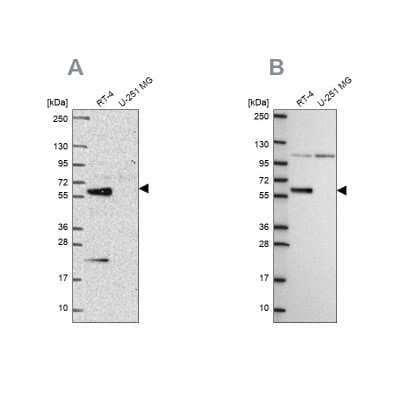 IRF6 Antibody (NBP2-49383): Novus Biologicals