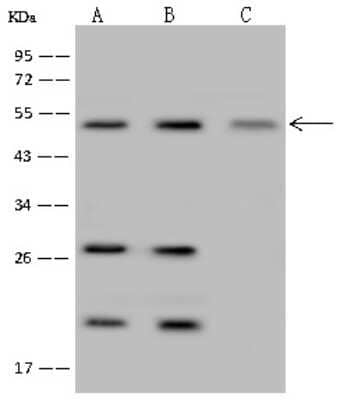IRF6 Antibody (NBP2-99348): Novus Biologicals