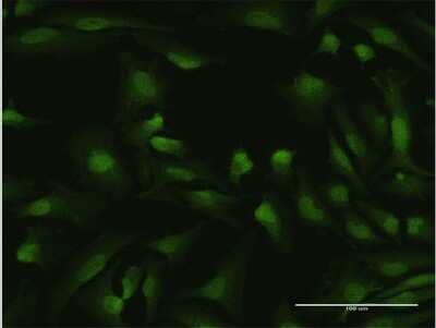 Ikaros/IKZF1 Antibody (H00010320-B01P): Novus Biologicals