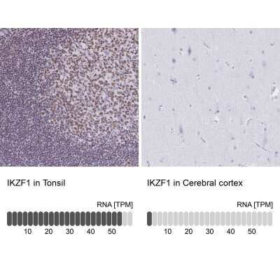 Ikaros/IKZF1 Antibody (NBP2-38242): Novus Biologicals