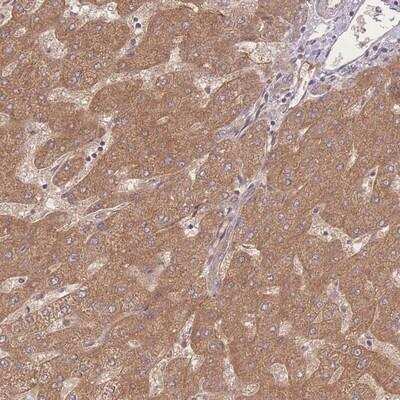 Insulin R/CD220 Antibody (NBP2-14124): Novus Biologicals