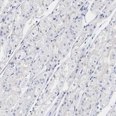 Integrin alpha 2b/CD41 Antibody (NBP1-84579): Novus Biologicals