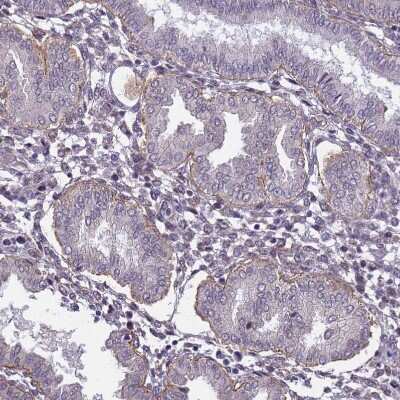 Integrin beta 4/CD104 Antibody (NBP2-38297): Novus Biologicals