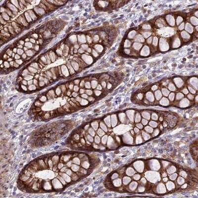 JMY Antibody (NBP1-83478): Novus Biologicals