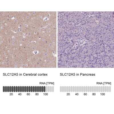 KCC2/SLC12A5 Antibody (NBP2-49674): Novus Biologicals