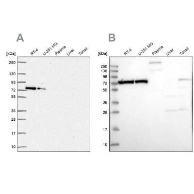 Ku70/XRCC6 Antibody (NBP2-38954): Novus Biologicals