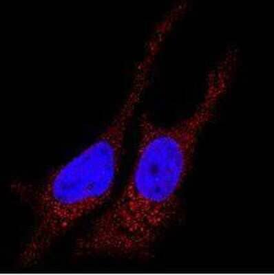 LC3 Antibodies: Novus Biologicals