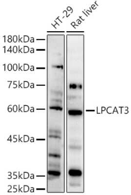 LPCAT3 Antibody - Azide and BSA Free (NBP3-04752): Novus Biologicals