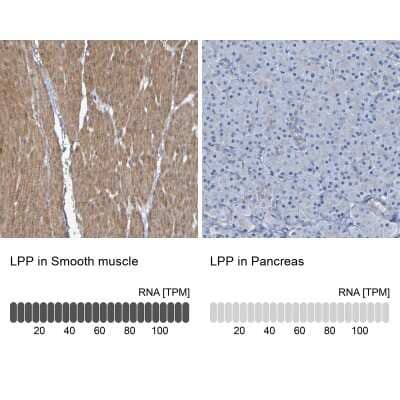 LPP Antibody (NBP1-89555): Novus Biologicals
