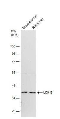 Lactate Dehydrogenase B Antibodies: Novus Biologicals