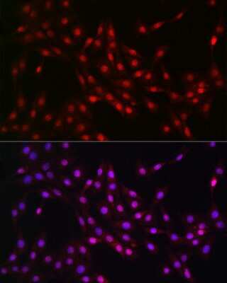 Lactyl-Lysine Antibodies: Novus Biologicals