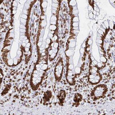 Lamin B1 Antibody (NBP2-48966): Novus Biologicals