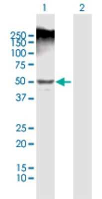 Lefty-1 Antibody (H00010637-D01P): Novus Biologicals