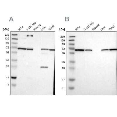 Leukotriene A4 Hydrolase/LTA4H Antibody (NBP1-90375): Novus Biologicals