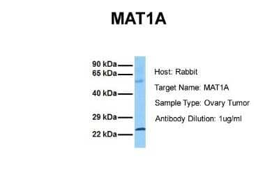MAT1A Antibodies: Novus Biologicals
