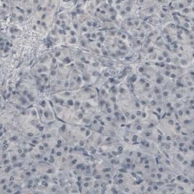 MBP Antibodies: Novus Biologicals