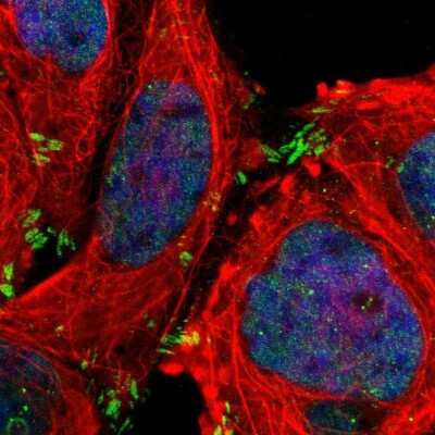 MDR1/ABCB1 Antibody (NBP1-90291): Novus Biologicals