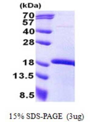 Recombinant Human MEOX 2 His Protein (NBP2-23228): Novus Biologicals