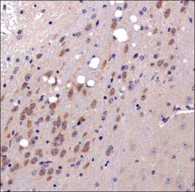 MMP-3 Antibody - BSA Free (NB100-91878): Novus Biologicals