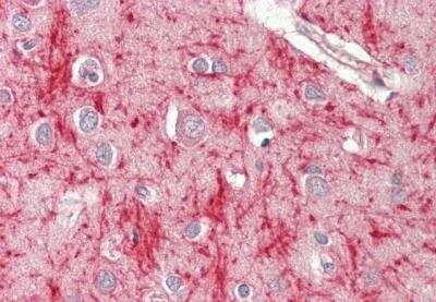 MSRB3 Antibody (NBP2-85332): Novus Biologicals