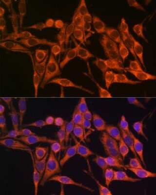 MT-ATP8 Antibody (NBP3-05560): Novus Biologicals