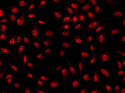 MX2 Antibody (NBP3-06565): Novus Biologicals