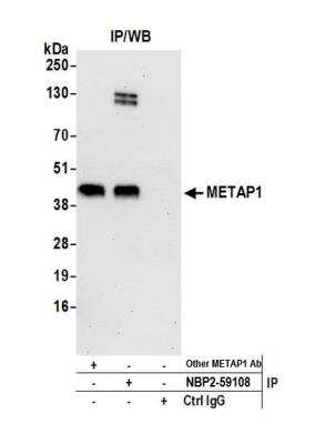 Methionine Aminopeptidase 1/METAP1 Antibody (NBP2-59108): Novus Biologicals