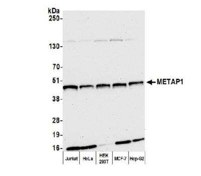 Methionine Aminopeptidase 1/METAP1 Antibody (NBP2-59108): Novus Biologicals