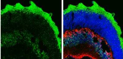 Musashi-1 Antibody (NBP1-32812): Novus Biologicals