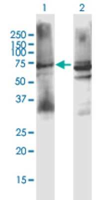 Muscarinic Acetylcholine Receptor M3/CHRM3 Antibody (H00001131-B01P ...