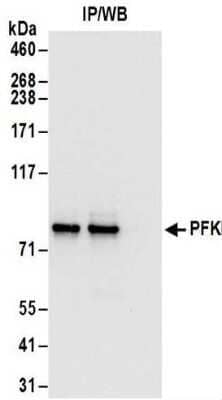 Muscle Phosphofructokinase/PFKM/PFK-1 Antibody (NBP2-32170): Novus ...