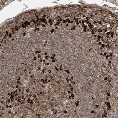 MxA/Mx1 Antibody (NBP1-83120): Novus Biologicals