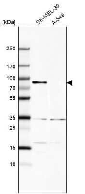 MxA/Mx1 Antibody (NBP1-83120): Novus Biologicals