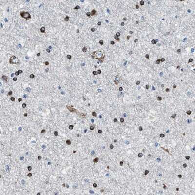 NACAD Antibodies: Novus Biologicals