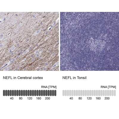 NF-L Antibody (NBP2-54669): Novus Biologicals
